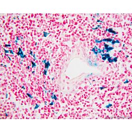 Hito Iron Positive Control Slides | Hitobiotec Corp.